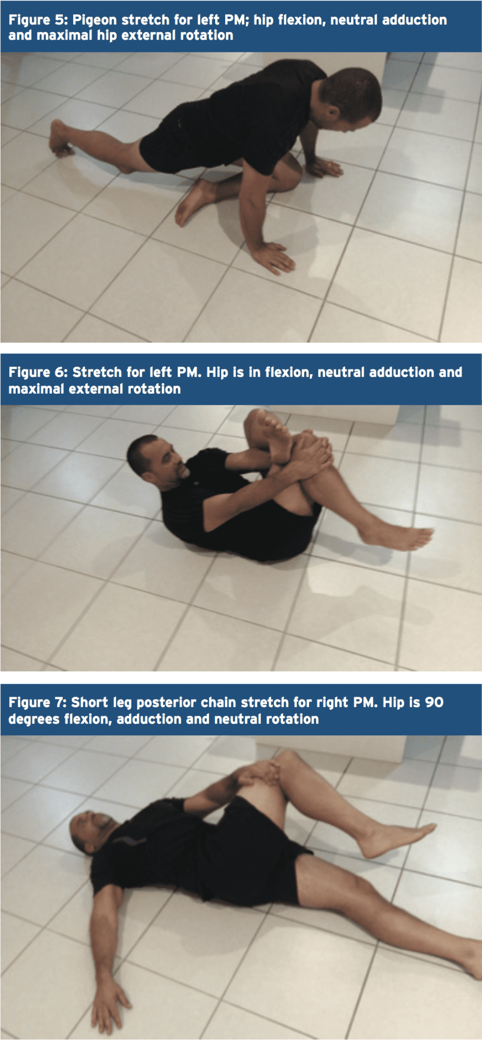 Piriformis Muscle: A Vicious Syndrome