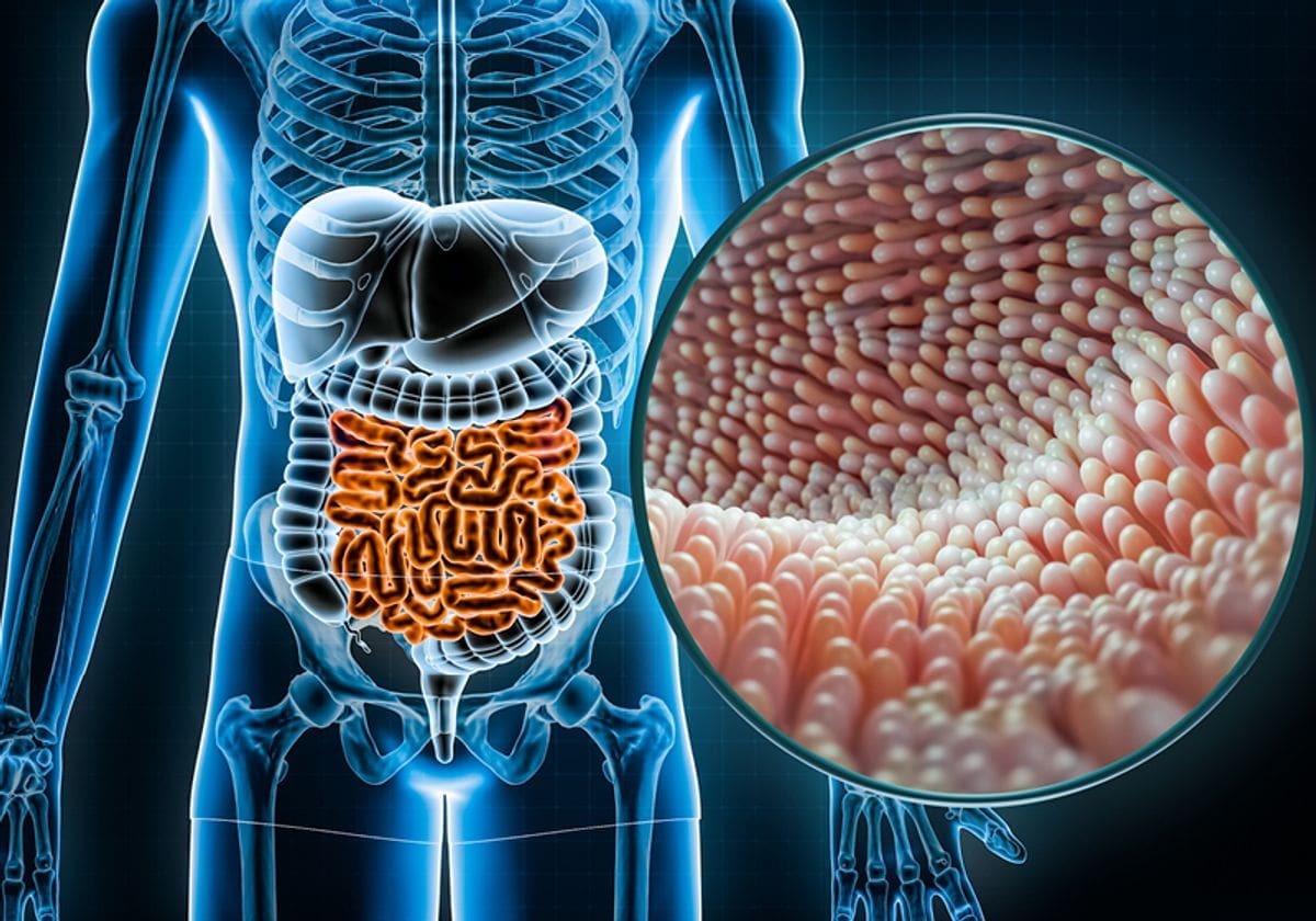 Effective Electroacupuncture Techniques to Relieve Gut Inflammation ...